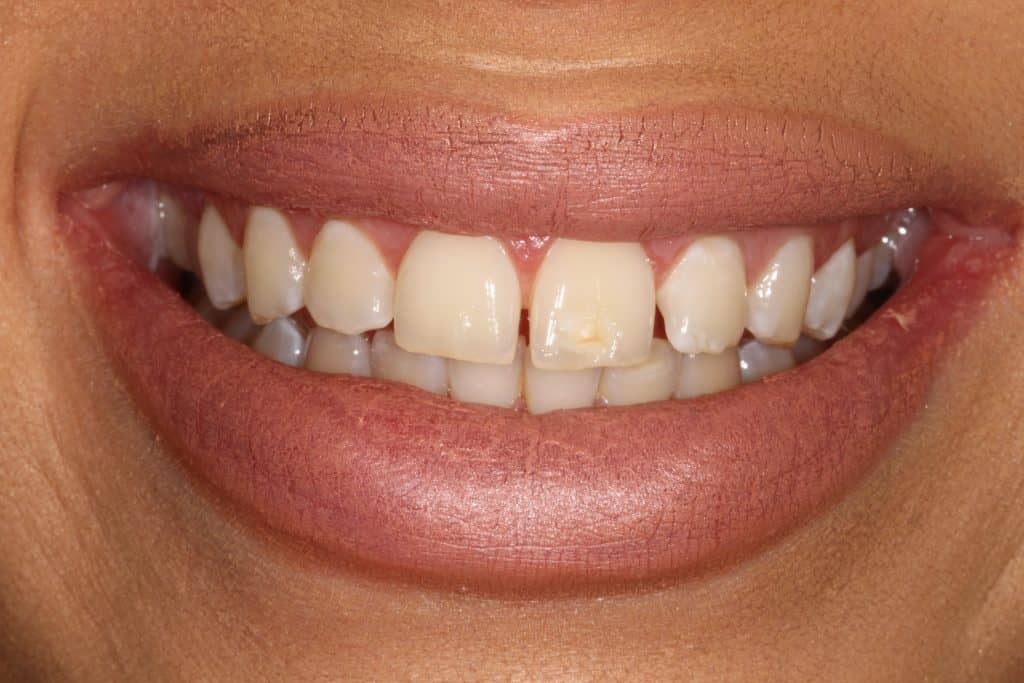 SmileFast - Newmarket Road Dental Clinic | Dentists Norwich
